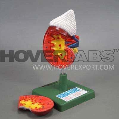 Human Kidney on Stand (Model No: HV-EM029) – HOVERLABS Online